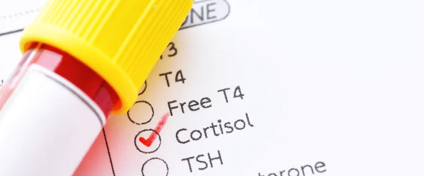 Cortisol Test: Meet Je Stress - Beste Test 2025 - Dokter Fit